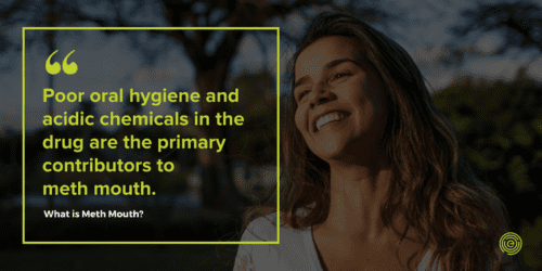 Meth Mouth: Methamphetamine Signs & Symptoms of Addiction